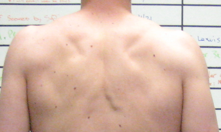 Mobility Exercise of the Week: Supine Alternating Shoulder Flexion on ...