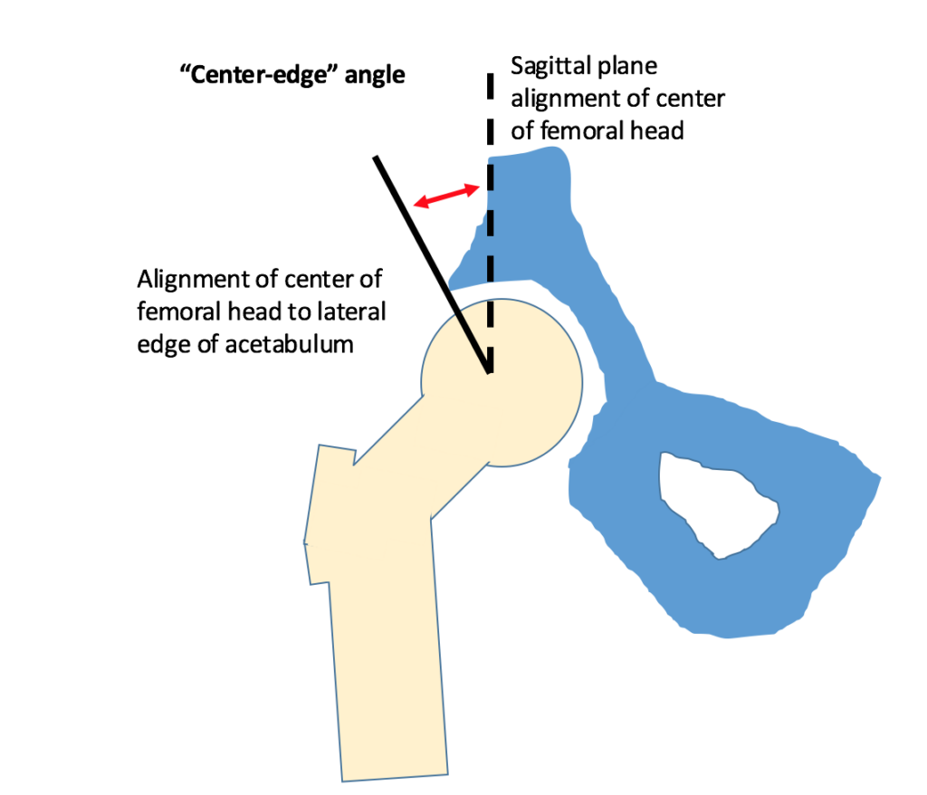 3 Principles for Understanding and Improving Mobility - EricCressey.com